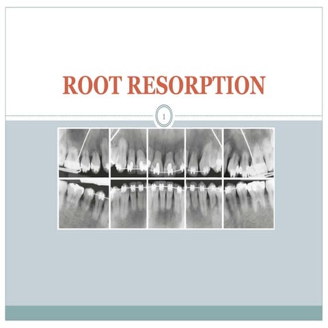 ROOT RESORPTION SEMINAR Root resorption is a pathological and physiological process that results ...