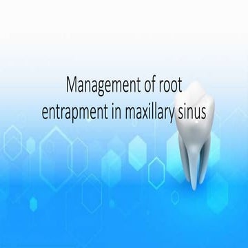 Management of root entrapment in maxillary sinus .pptx