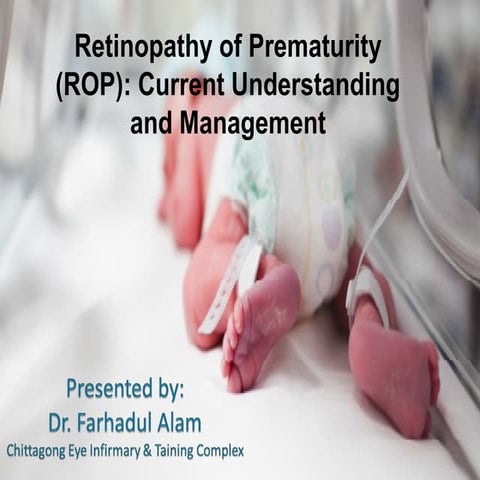 ROP current understanding and management | PPT
