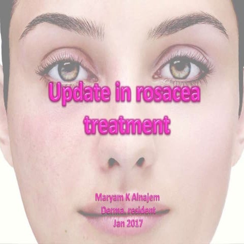 An Update on Rosacea Treatment | PPTX