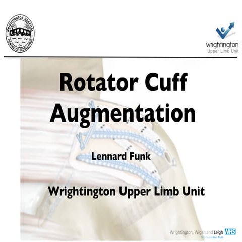 Rotator Cuff Augment 2018.pdf