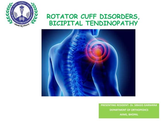 Rotator cuff tear | PPTX