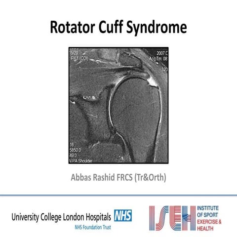 Rotator cuff syndrome | PPTX