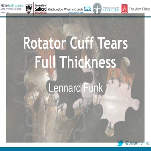 Rotator cuff tear management 2019 | PDF