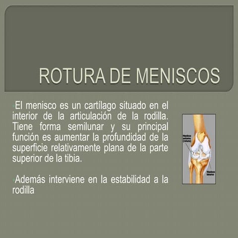 Rotura de meniscos | PPTX