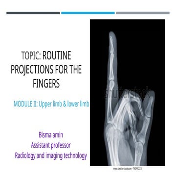 RADIOGRAPHIC TECHNIQUE OF UPPER LIMB BY SAGAR CHAULAGAIN | PPTX