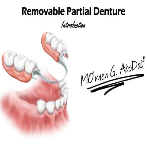 Removable Partial Denture 1. Introduction | PDF