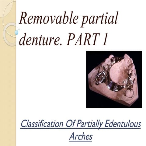 RPD Classification. | PDF