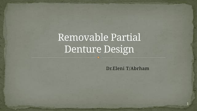 removable partial denture survey lines, path of insertion, guide planes ...