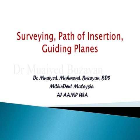 Rpd surveying 2nd yr | PPTX