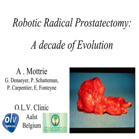 Radical Prostatectomy for Prostate Cancer | PPT