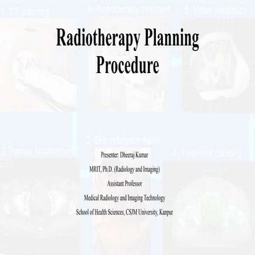 Radiotherapy Treatment Planning Procedure.pptx