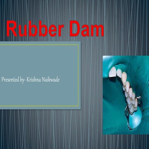 Rubber dam | PPTX