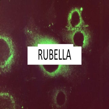 Rubella | PPTX
