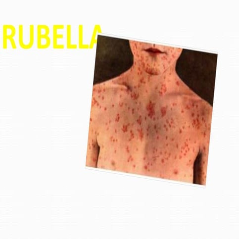 rubella.pptx