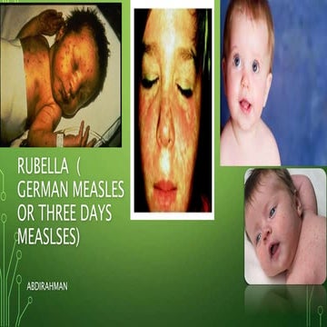 Rubella ( german measles or three days measlses | PPTX