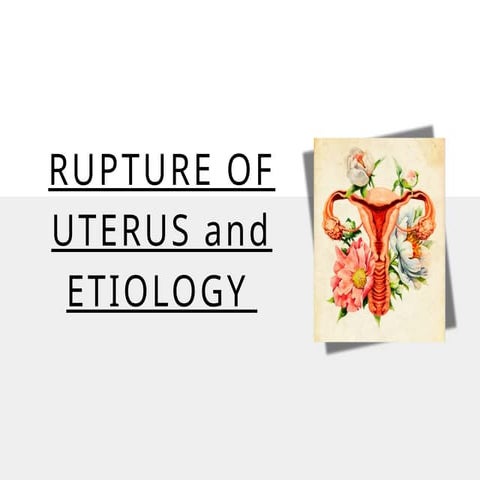 RUPTURE OF UTERUS and ETIOLOGY.pptx.pptx