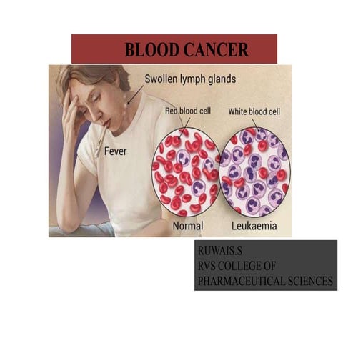 BLOOD CANCER | PPTX
