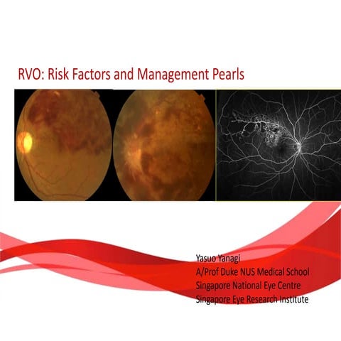 RVO risk factors and management pearls | PPTX