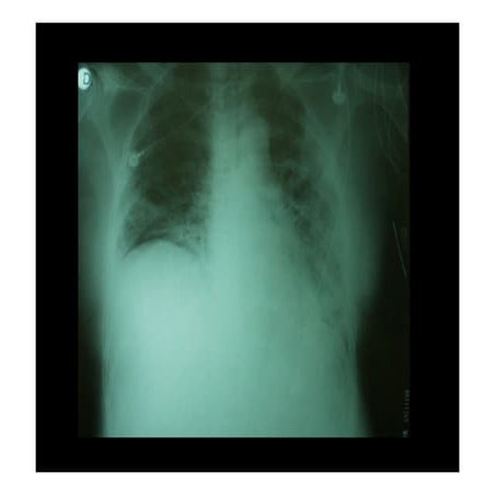 Rx | PDF