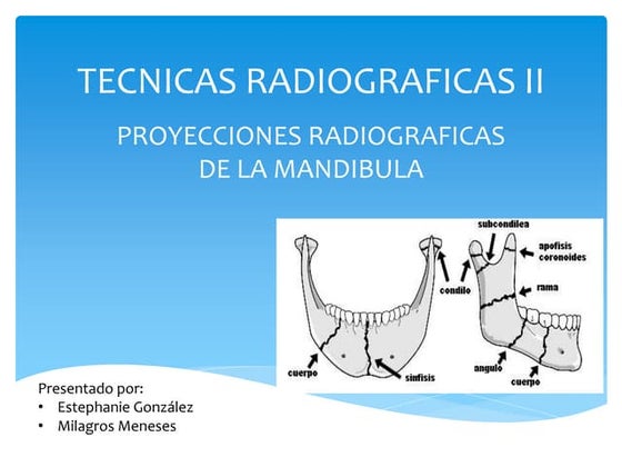 Proyecciones radiológicas del cráneo | PPT
