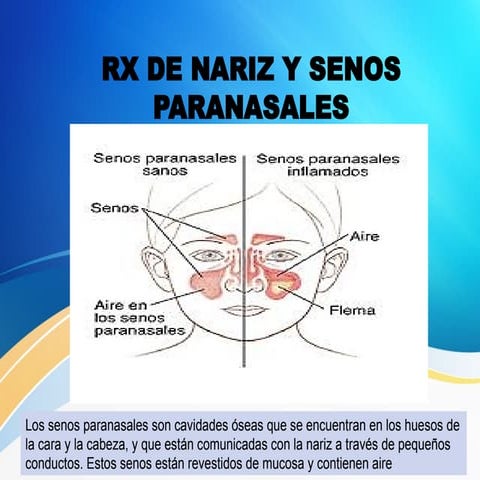 RADIOGRAFIA DE SENOS PARANASALES PEDIATRIA | PPTX