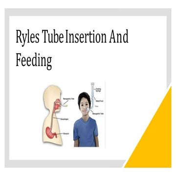 ryles tube insertion and feeding | PPTX