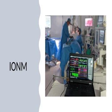 Presentation_IONM_CME. PowerPoint presentation | PPT