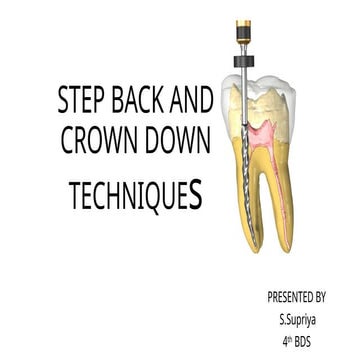 Step back and crown down technique in root canal treatment | PPTX