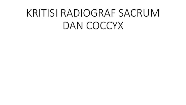 Transitional vertebrae radiology | PPTX
