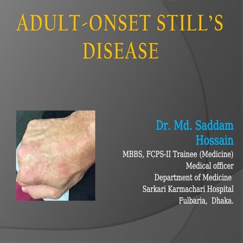Adult onset still's disease (AOSD) Presented by Dr.Md.Saddam Hossain ...
