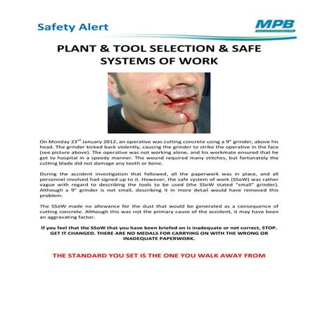 Safety Alert on Eye Injury | PDF