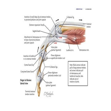 Sagital band, EDC rupture inindajdjadjajdi.pptx