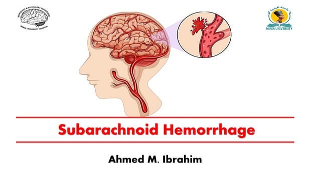 Subarachnoid hemorrhage | PPTX