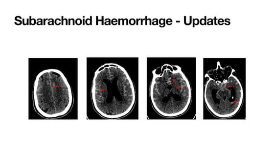 Nolla staging and Dental Age(Orthdontics) | PPT