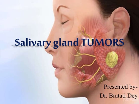 Pleomorphic Adenomas of the Salivary Glands | PPTX | Ear, Nose and Throat Conditions | Diseases ...