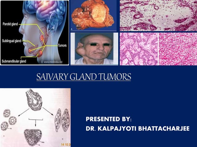 2022 WHO Salivary gland tumors update.pdf