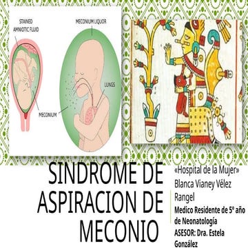 Sindrome de Aspiracion de Meconio en Neonatologia.pptx