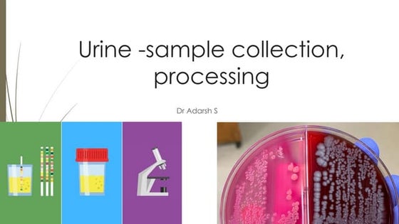 URINE SPECIMEN COLLECTION, PROCESSING AND PACKAGING.pptx