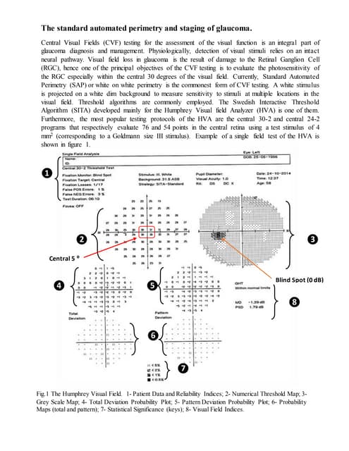 Humphry visual field analysis | DOCX | Eye and Vision Conditions | Diseases and Conditions