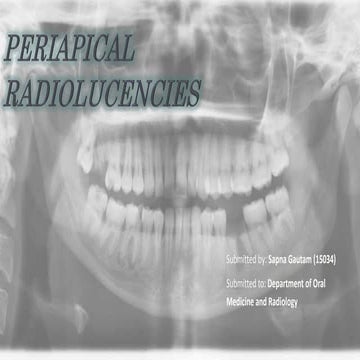 periapical radiolucencies | PPTX