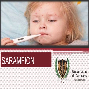 Sarampión | PPTX