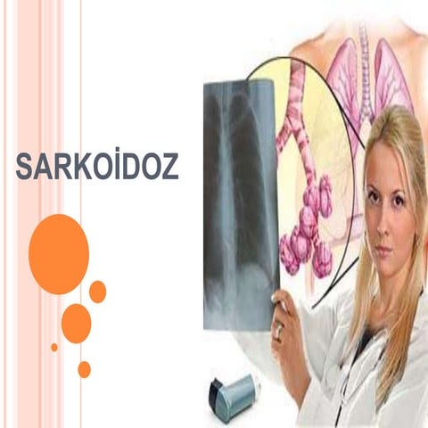 Sarkoidoz | PPTX