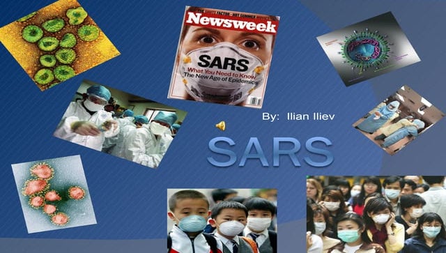 SARS