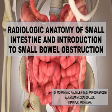 Small bowel vs large.pptx