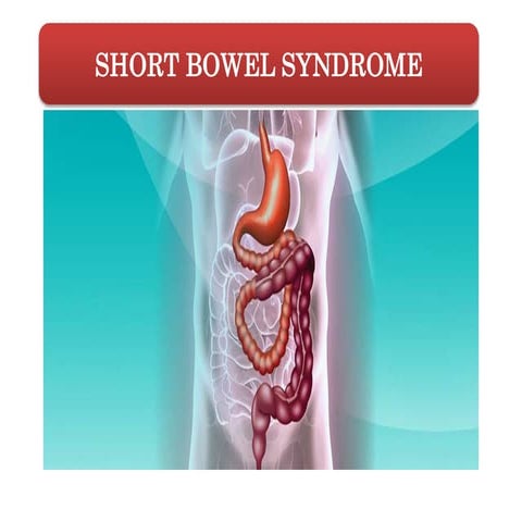 SHORT BOWEL SYNDROME | PPTX