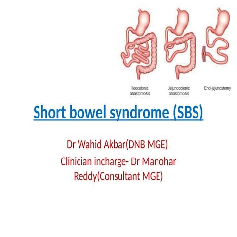 Short bowel syndrome | PPTX