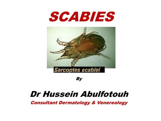 Scabies | PPTX | Allergies | Diseases and Conditions