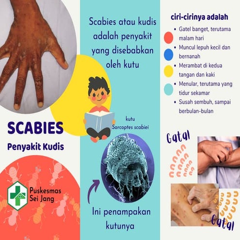 scabies.pdf