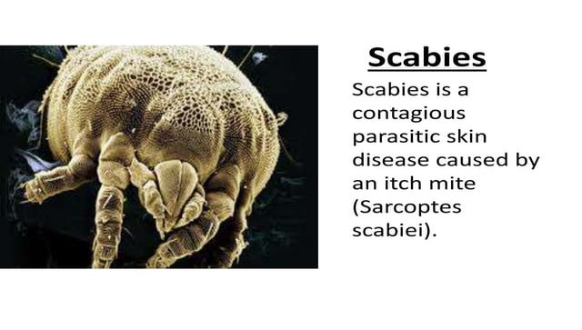 Scabies Bug Treatment